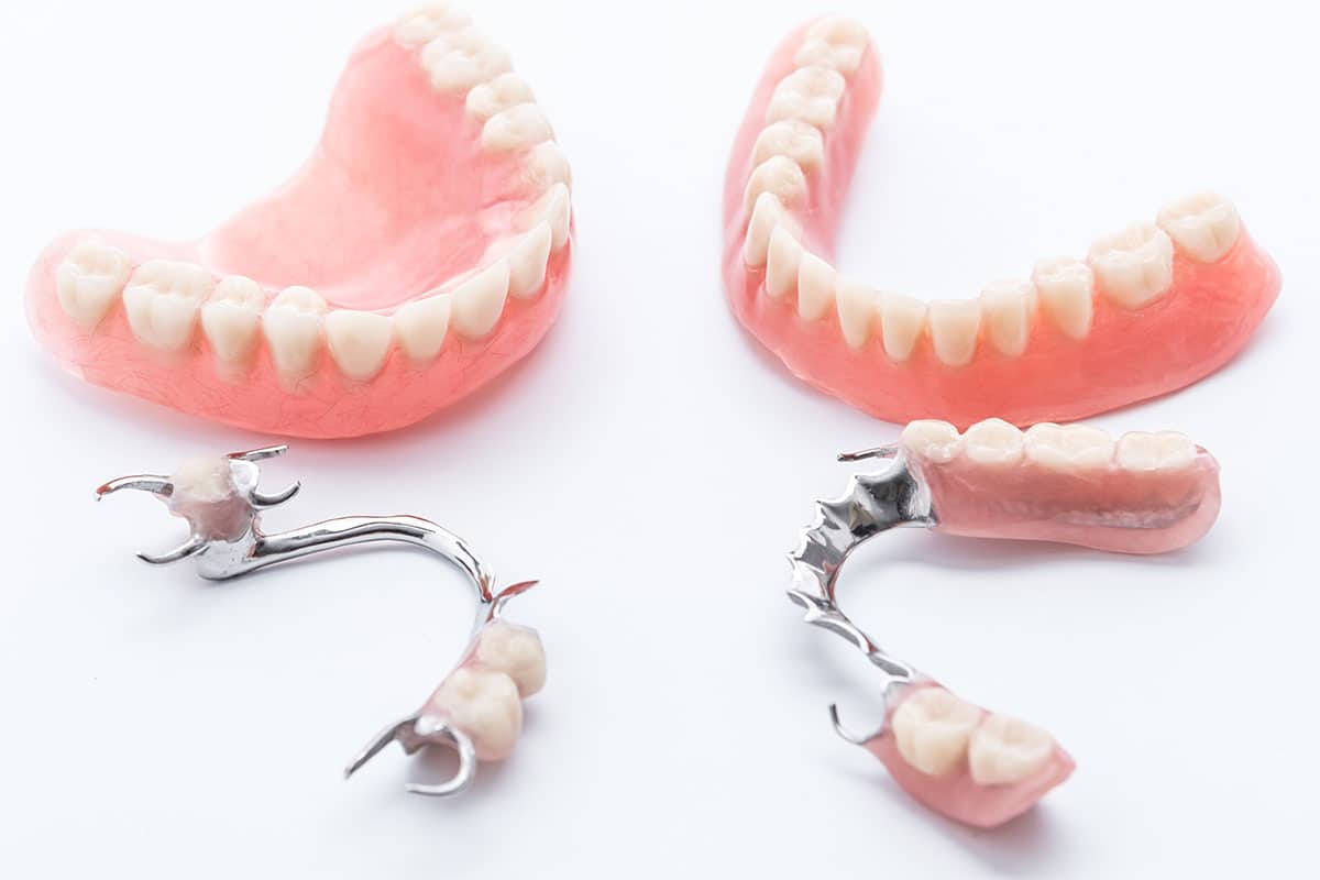 Delprotese - Tand & Teknik